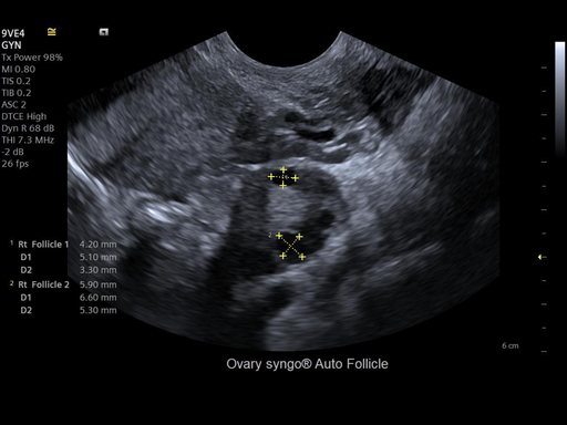 ACUSON Maple is a High-Performance Shared Service Ultrasound System ...