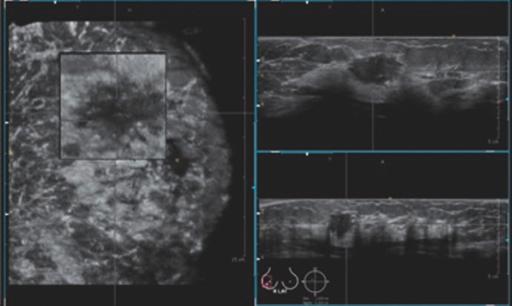 Milestones in Ultrasound Diagnostics - Siemens Healthineers USA
