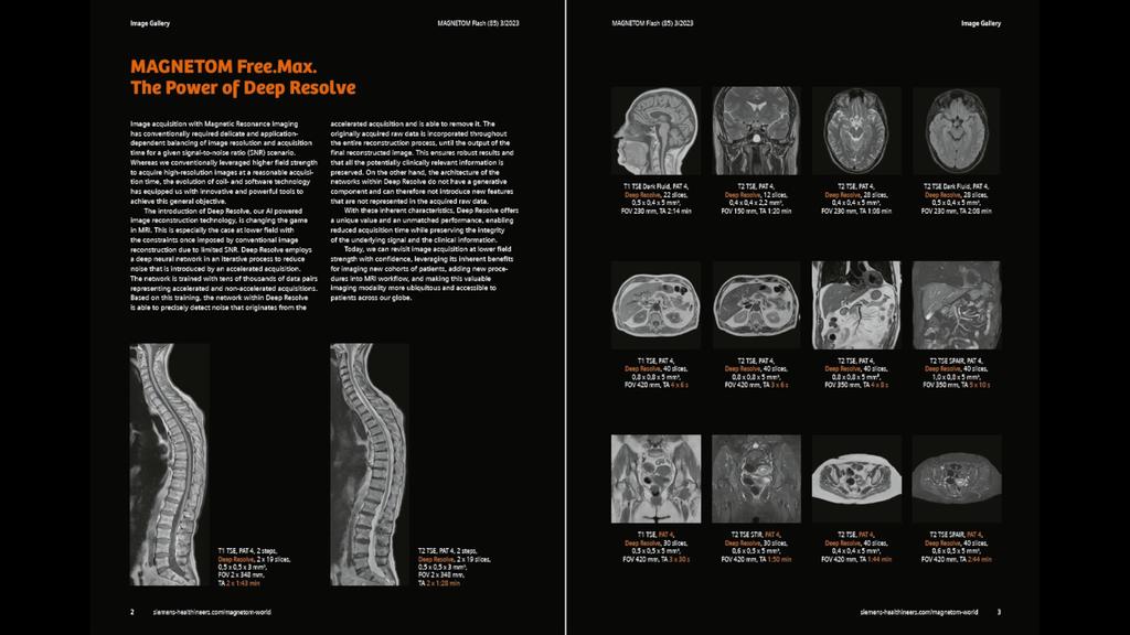 Deep Resolve Phoenix images for MAGNETOM Free.Max 0.55T