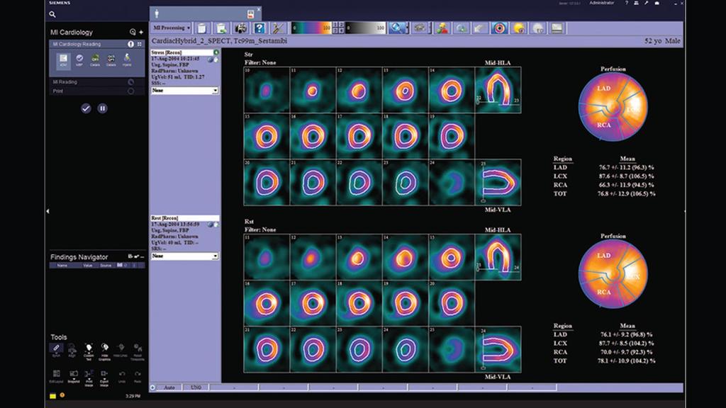 syngo.via for MI - Siemens Healthineers USA