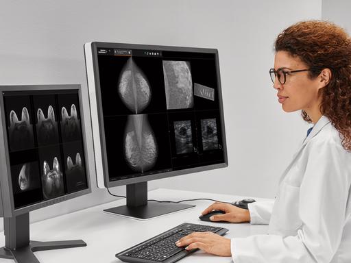 High Definition Breast Tomosynthesis – Siemens Healthineers - Siemens ...
