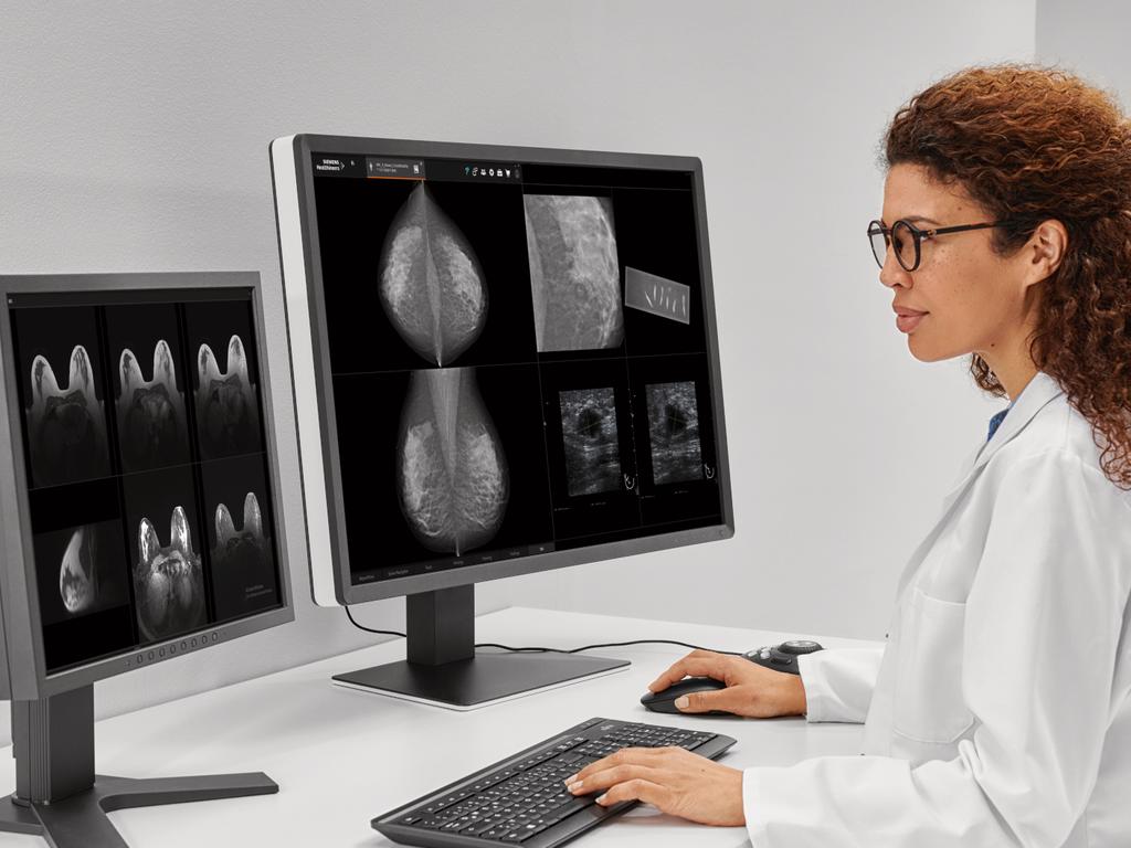 High Definition Breast Tomosynthesis – Siemens Healthineers - Siemens ...