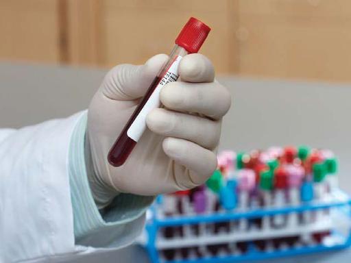 ELF Test - Siemens Healthineers USA