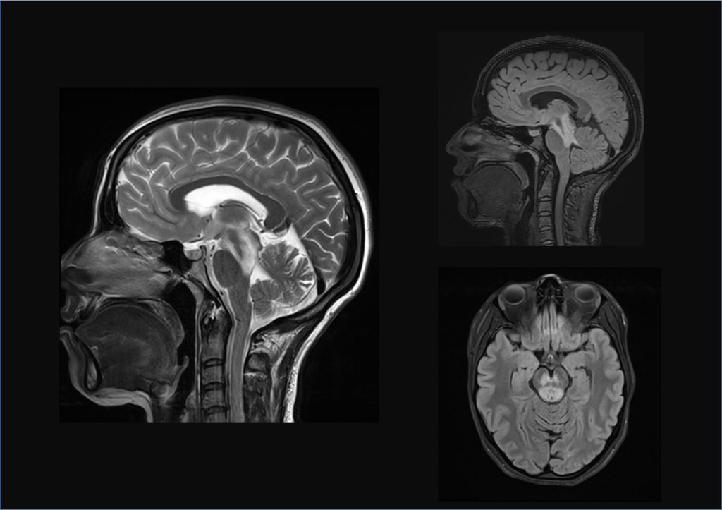 Introducing 3T MR Imaging with the New MAGNETOM Vida