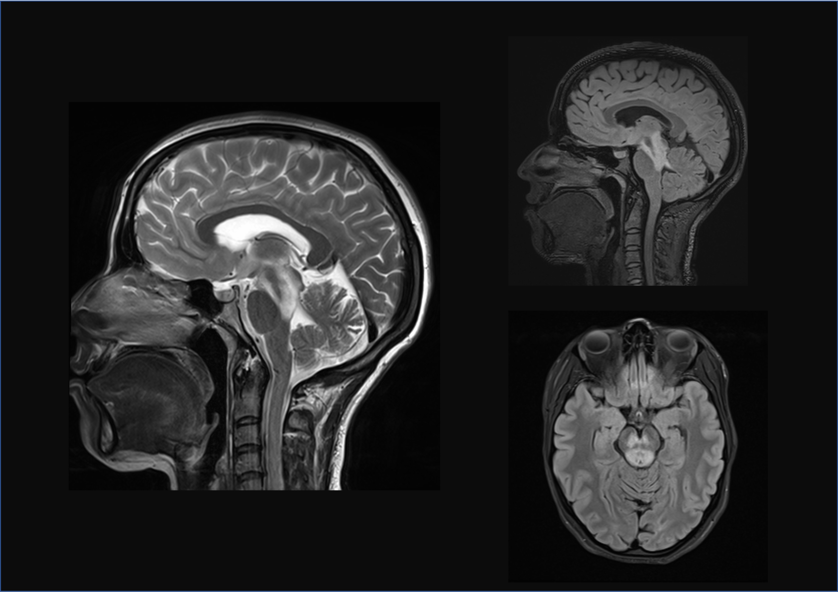 Introducing 3T MR Imaging with the New MAGNETOM Vida