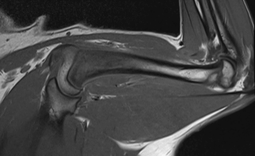 Magnetic Resonance Imaging - Siemens Healthineers USA