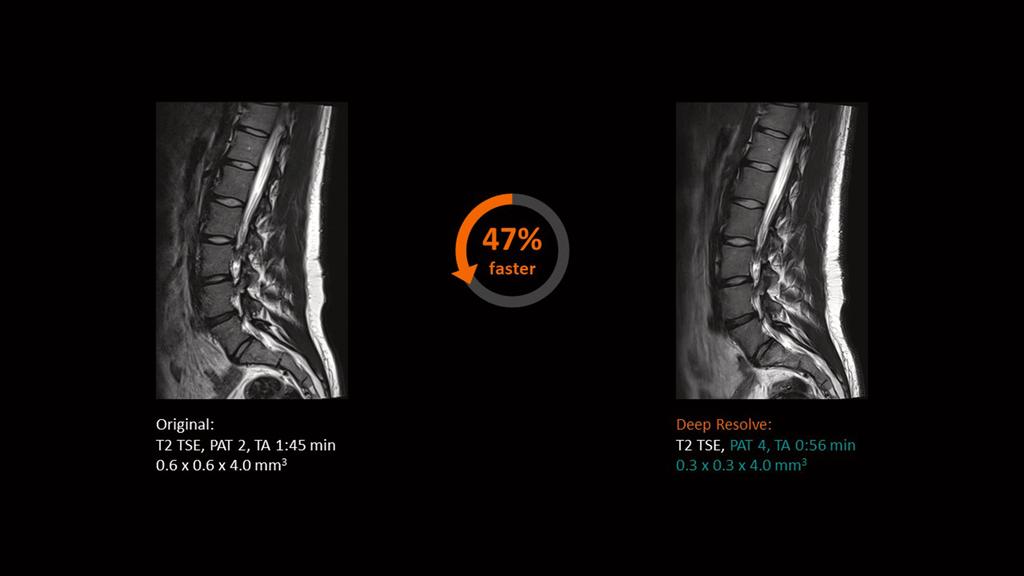 MAGNETOM Vida - Leading the field - Siemens Healthineers