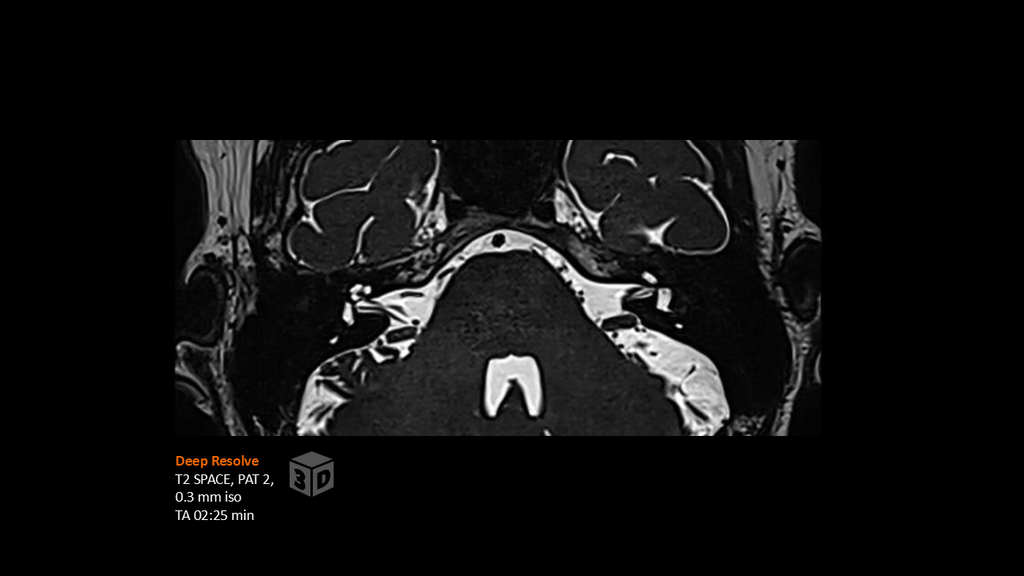 MAGNETOM Altea 新時代に求められる生産性と再現性 - Siemens Healthineers Japan