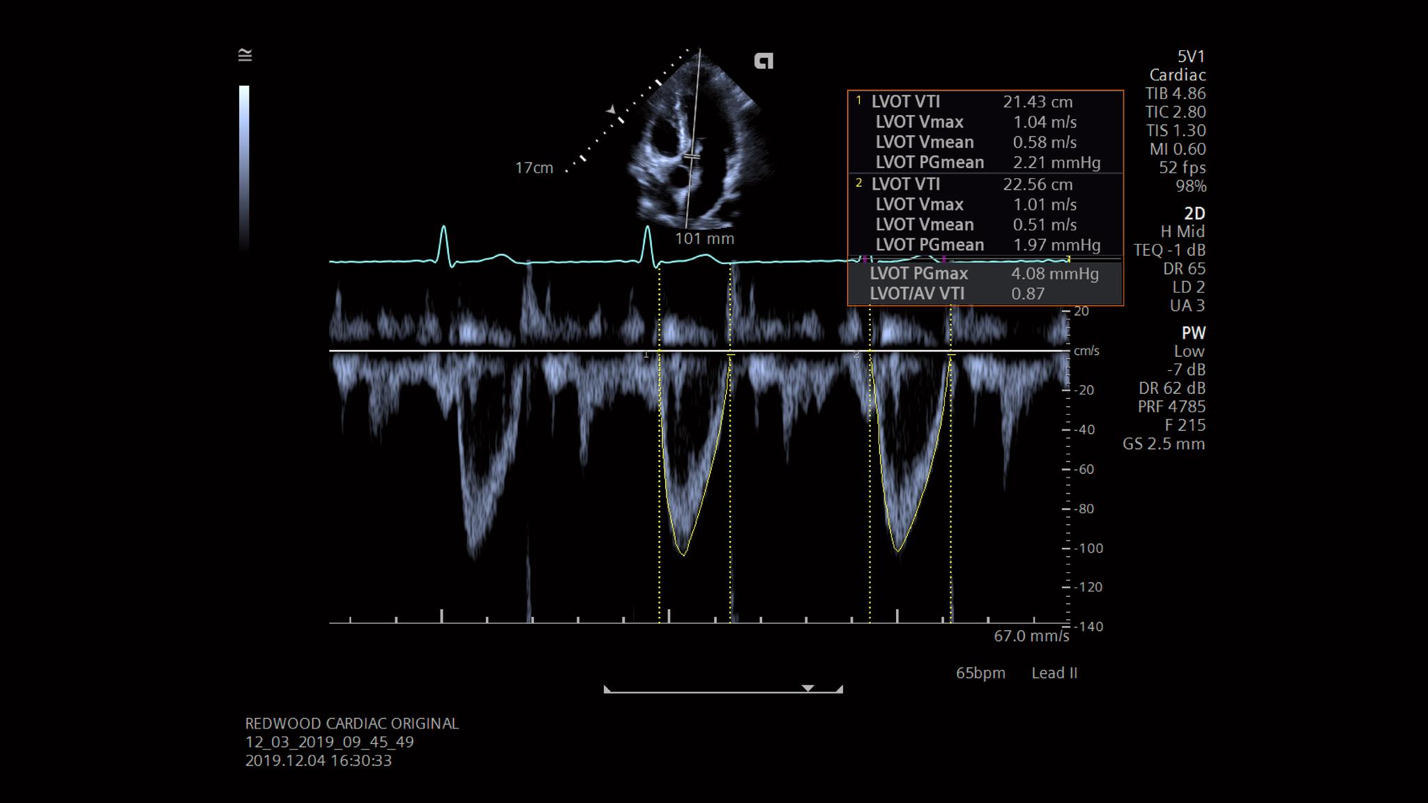 A New Era for Cardiac Ultrasound - Siemens Healthineers Malaysia