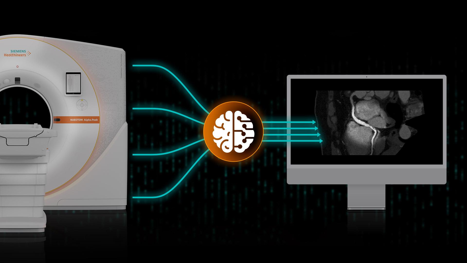 NAEOTOM Alpha.Pro - Siemens Healthineers