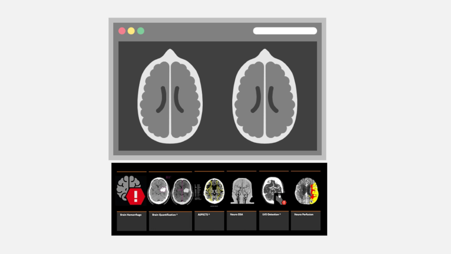 Pre-hospital stroke diagnosis & care - Siemens Healthineers