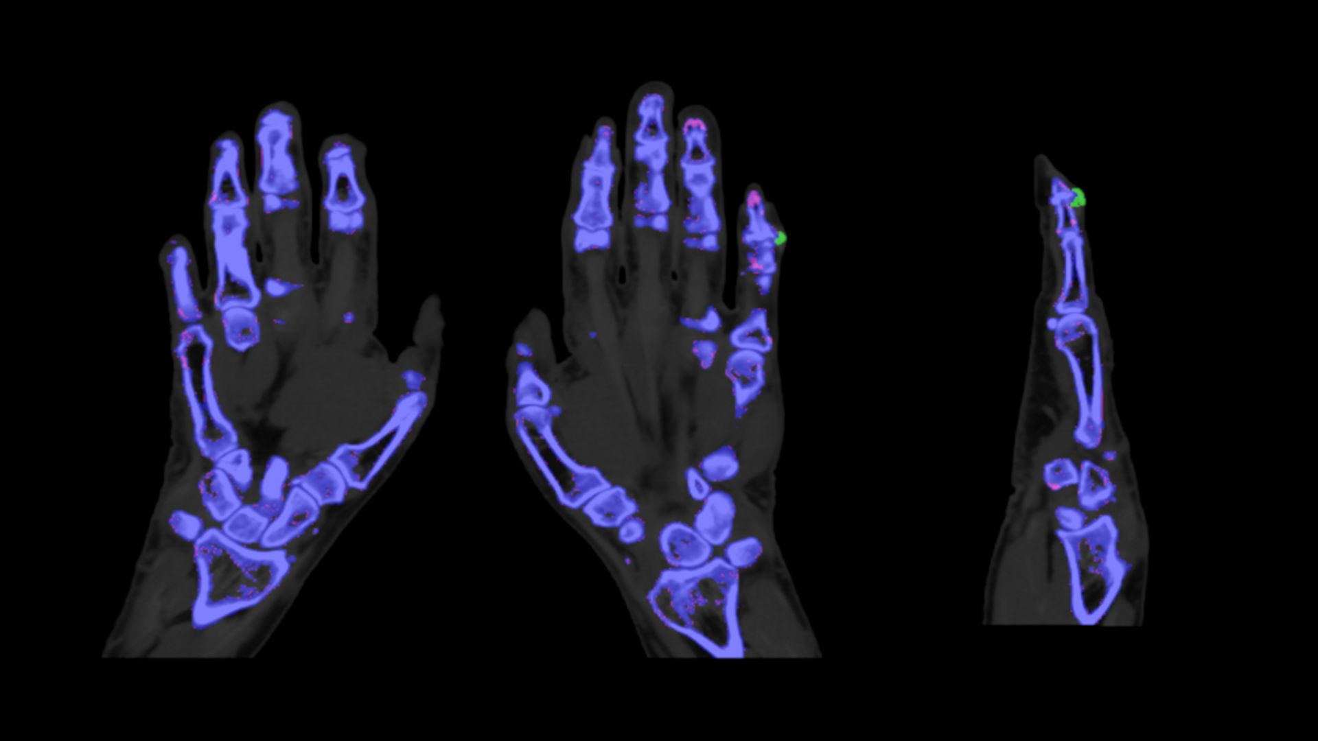 The difference between images and answers with Dual Energy CT - Siemens ...
