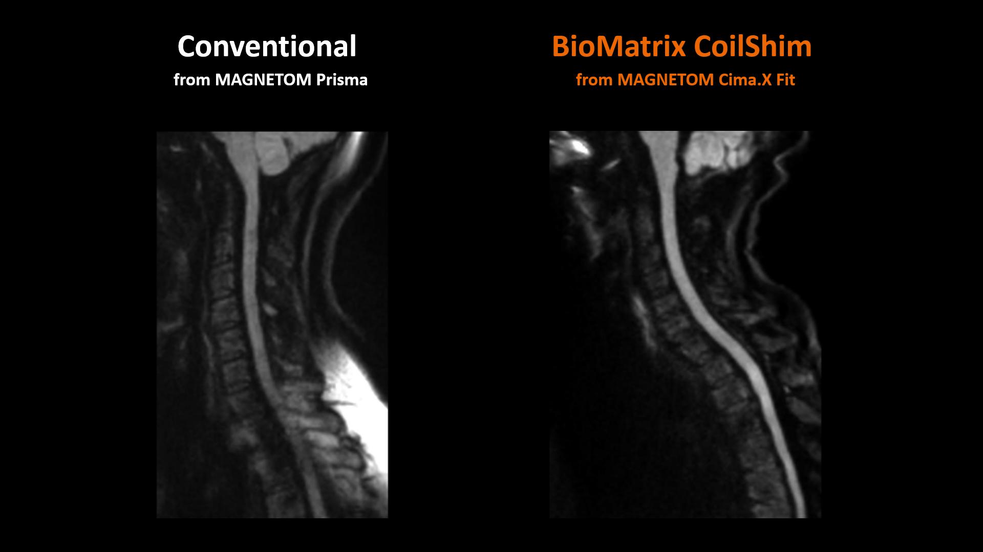 MAGNETOM Cima.X Fit - Siemens Healthineers