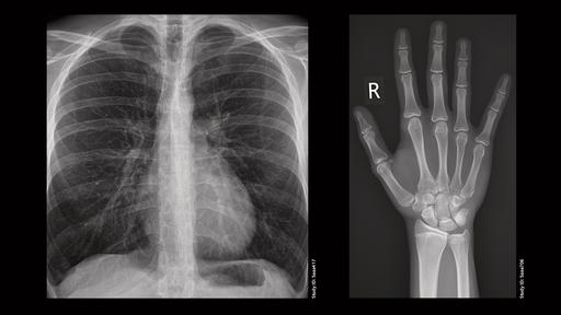 MULTIX Impact C with myExam Companion - Siemens Healthineers USA