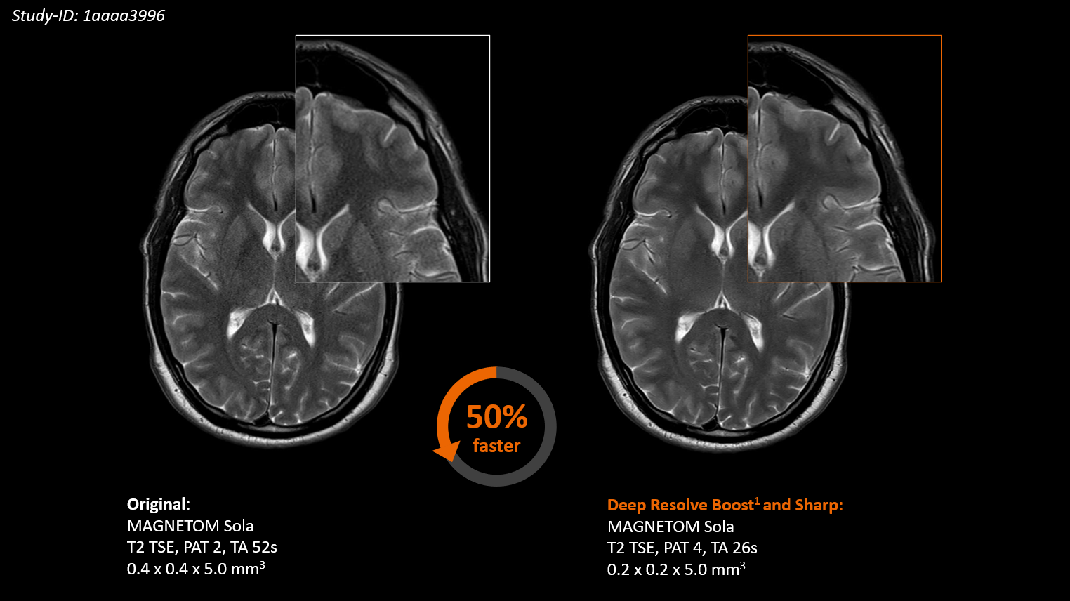 MAGNETOM Sola - Siemens Healthineers USA