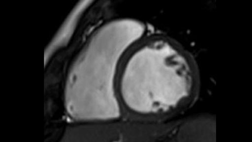 Classe virtuelle - Initiation et bases de l’IRM cardiaque - Partie 1 ...