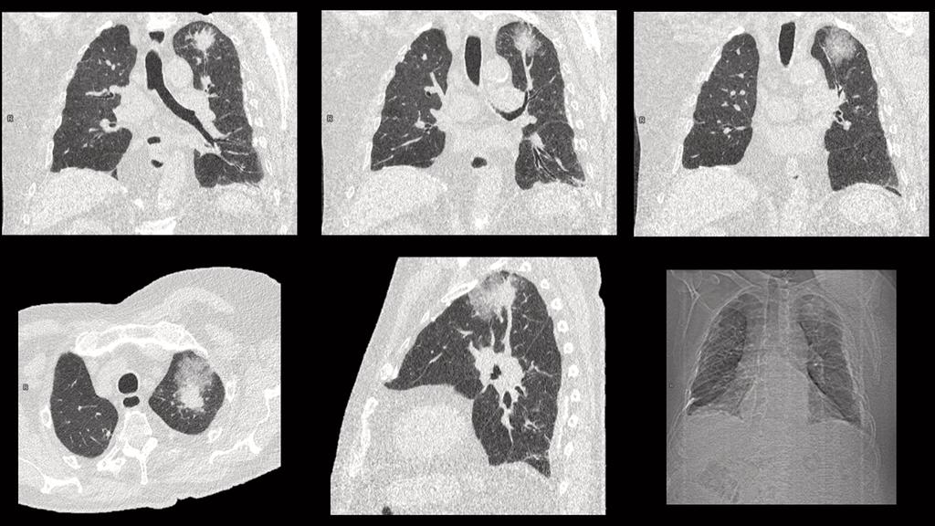The Siemens Healthineers CT Imaging Chain - Siemens Healthineers