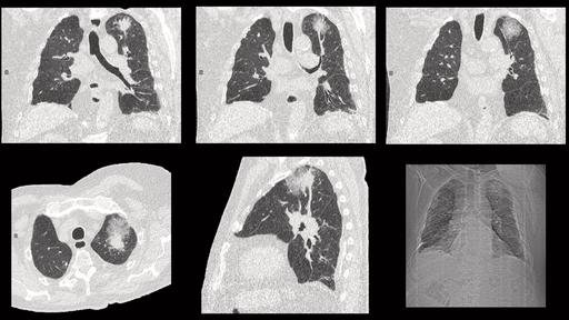 The Siemens Healthineers CT Imaging Chain - Siemens Healthineers