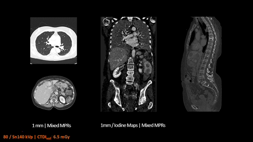 Dual Source CT - Siemens Healthineers