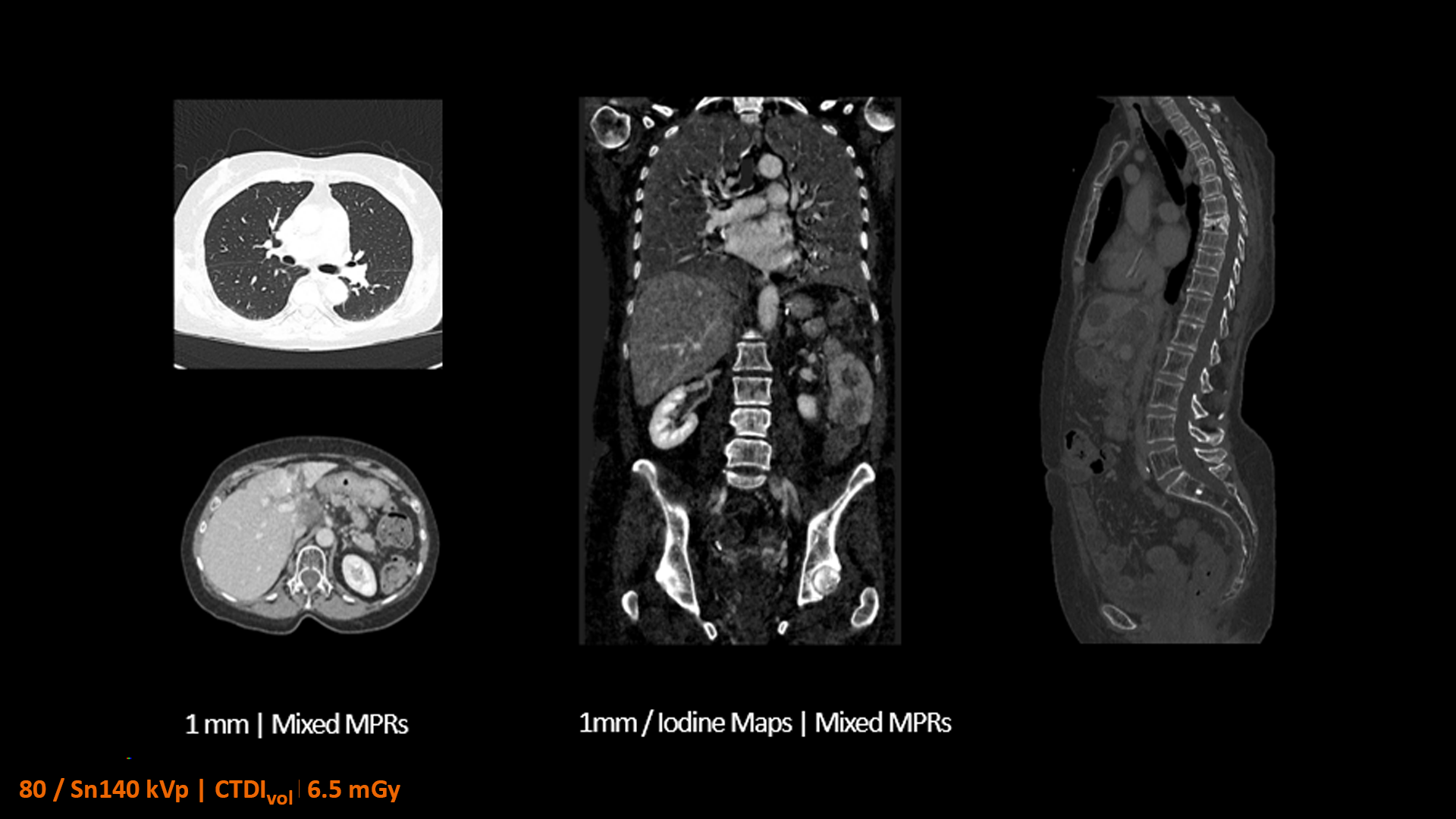 Dual Source CT - Siemens Healthineers
