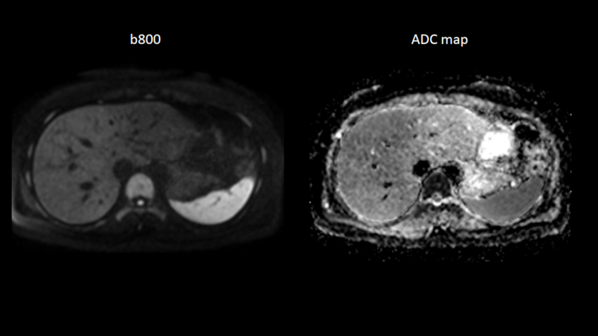 MAGNETOM Free.Star - Siemens Healthineers USA