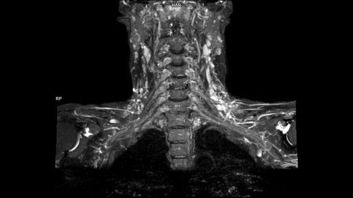 T2 SPACE STIR COR Thin MIP-MAGNETOM Sola - Siemens Healthineers USA