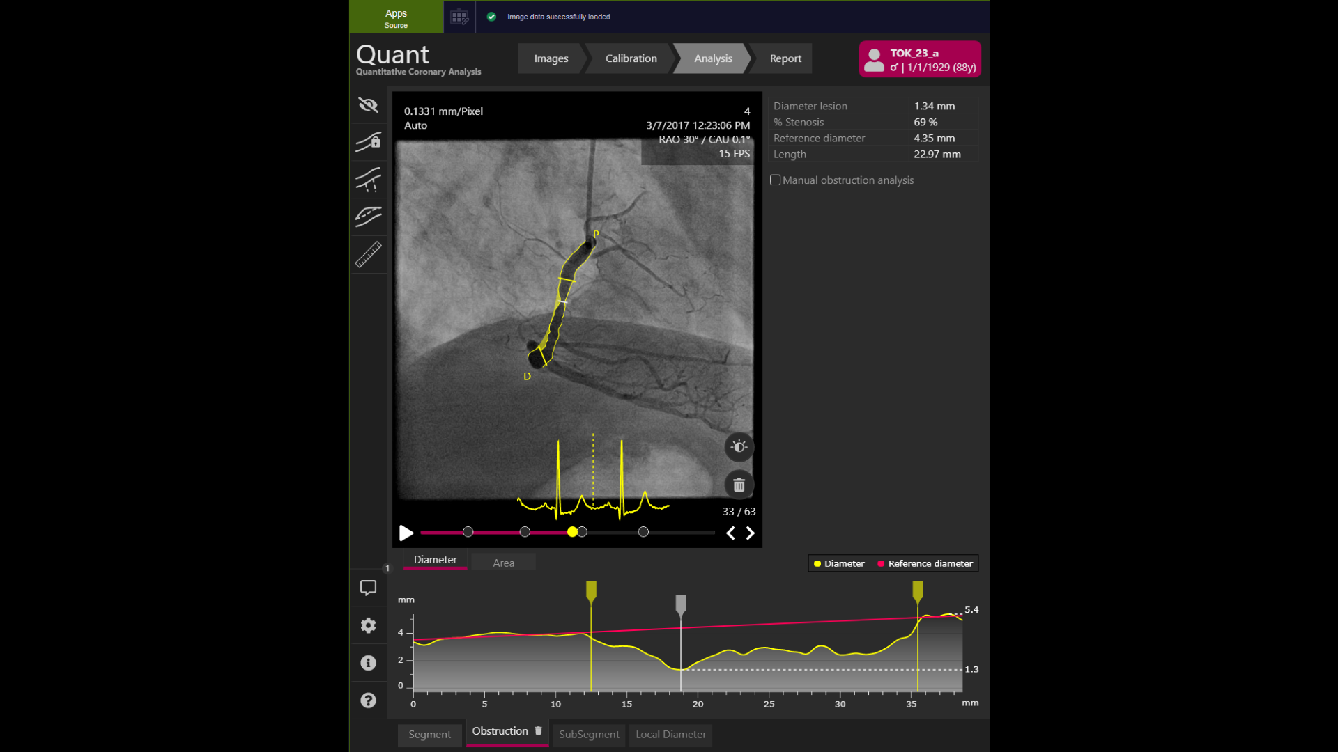 Scientific QCA Analysis - Siemens Healthineers