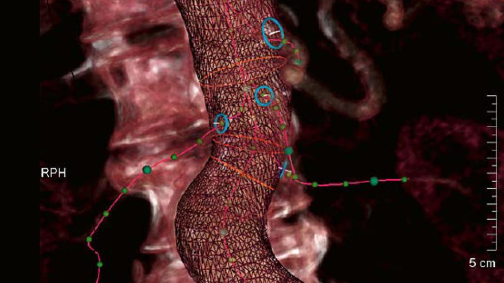 Artis Q - Siemens Healthineers