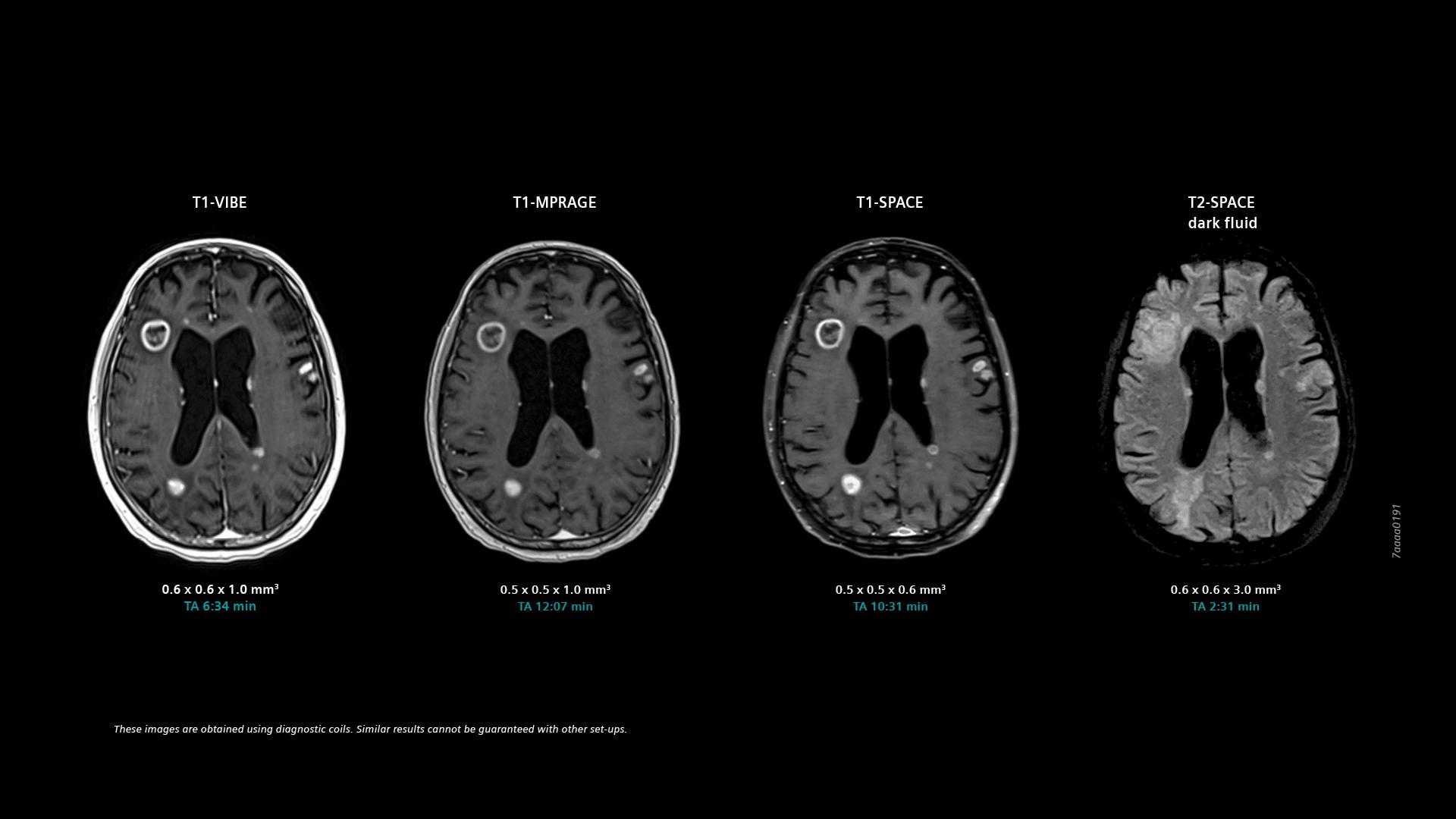 MAGNETOM Free.Max RT Edition - Siemens Healthineers