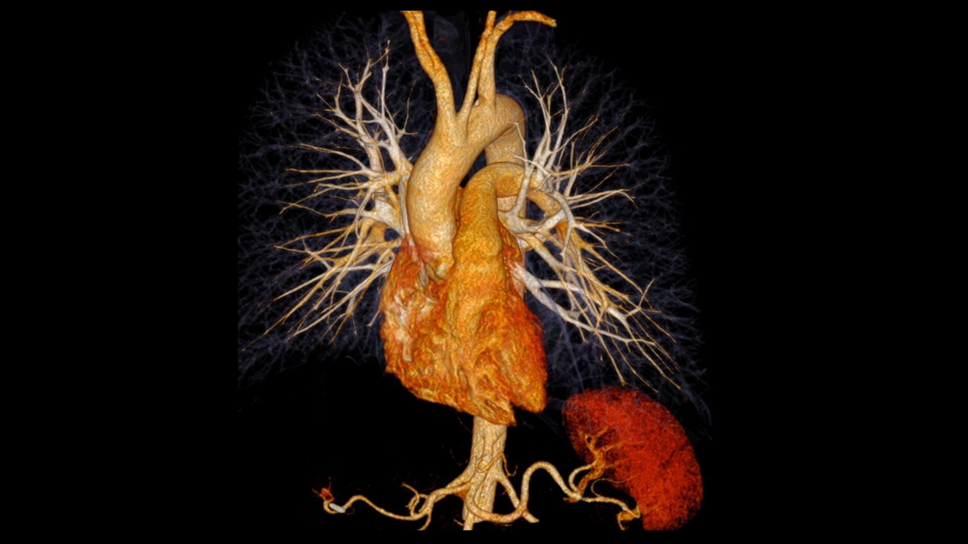 The SOMATOM go. platform – Made to match - Siemens Healthineers USA
