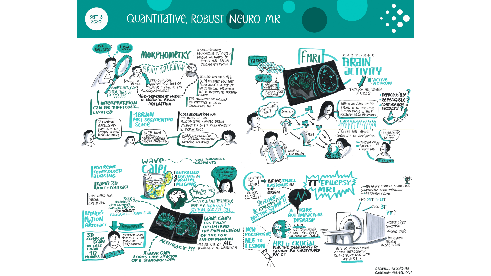 Quantitative, Robust Neuro MRI