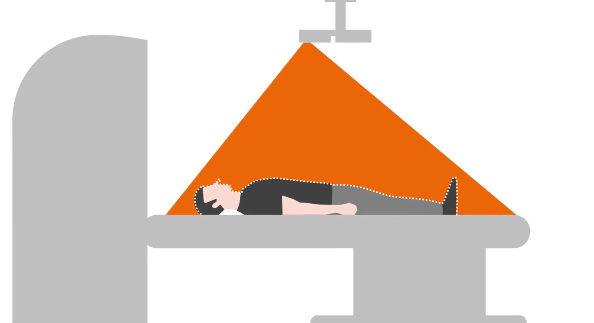 FAST 3D Camera - positionnement patient au scanner - Siemens Healthineers France