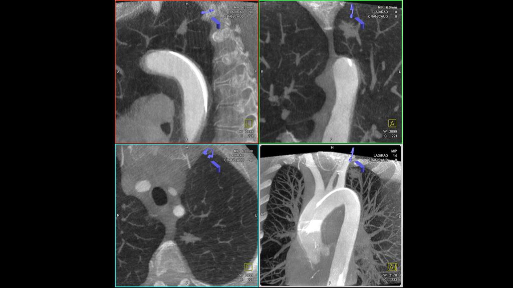 syngo DynaCT - Siemens Healthineers USA