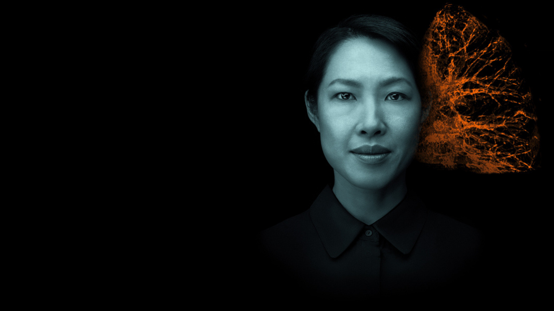 Mobile 3D C-Arms for Image-Guided VATS - Siemens Healthineers USA