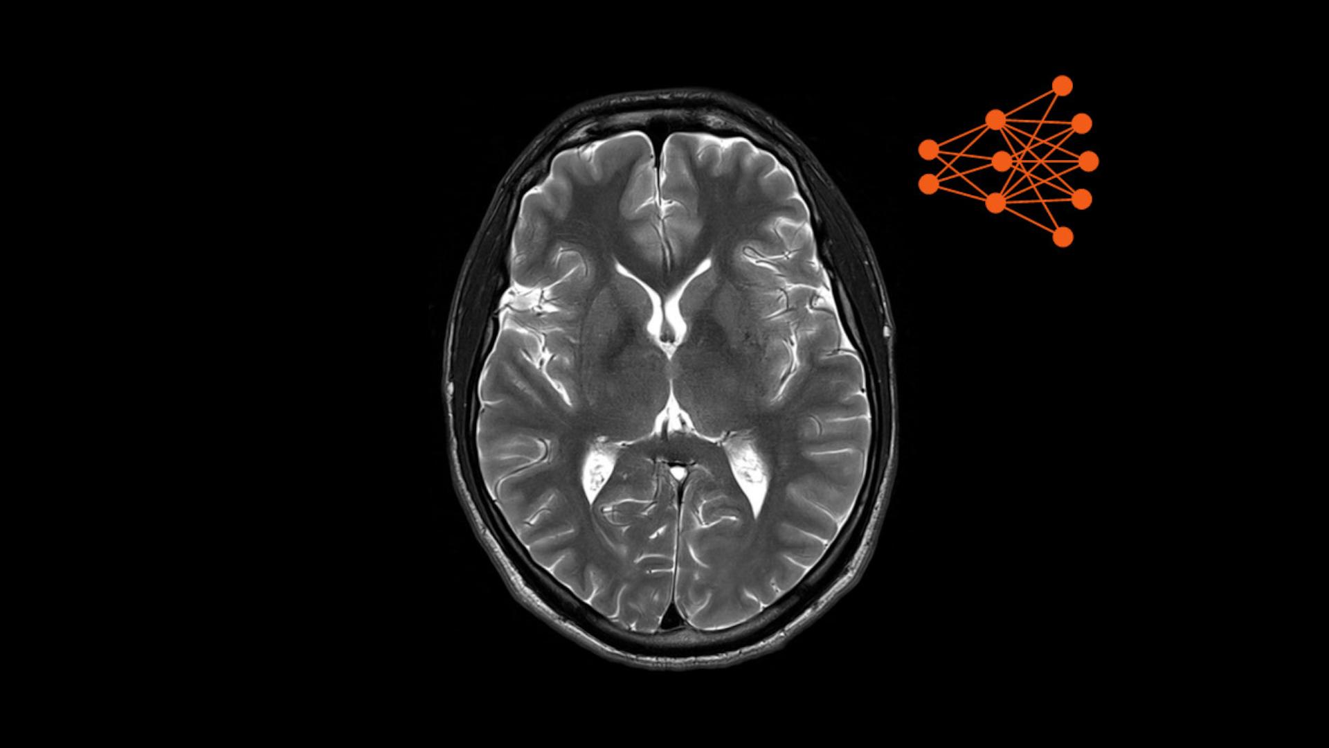 Pediatric MRI - Siemens Healthineers