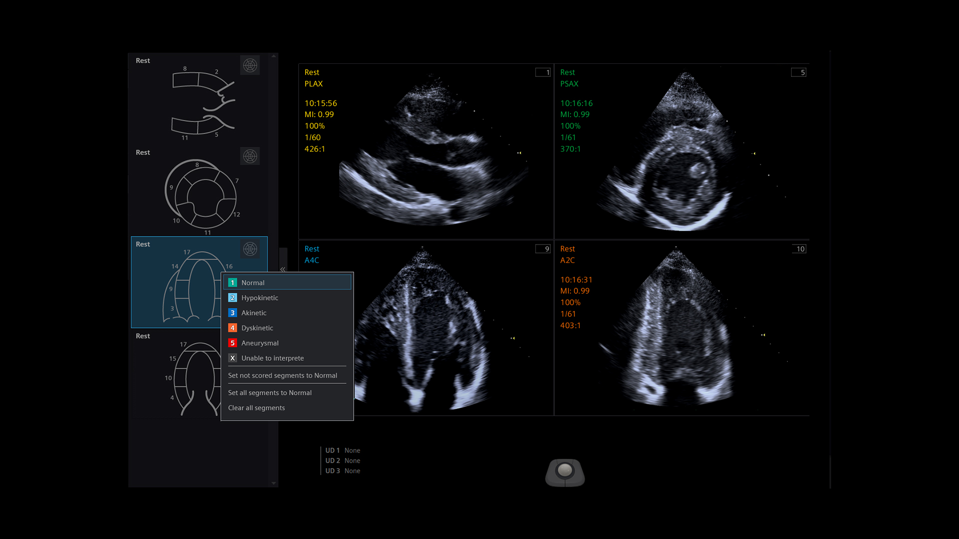 ACUSON Juniper, CV Edition Ultrasound System - Siemens Healthineers