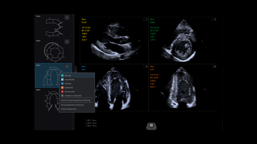 ACUSON Juniper, CV Edition Ultrasound System - Siemens Healthineers