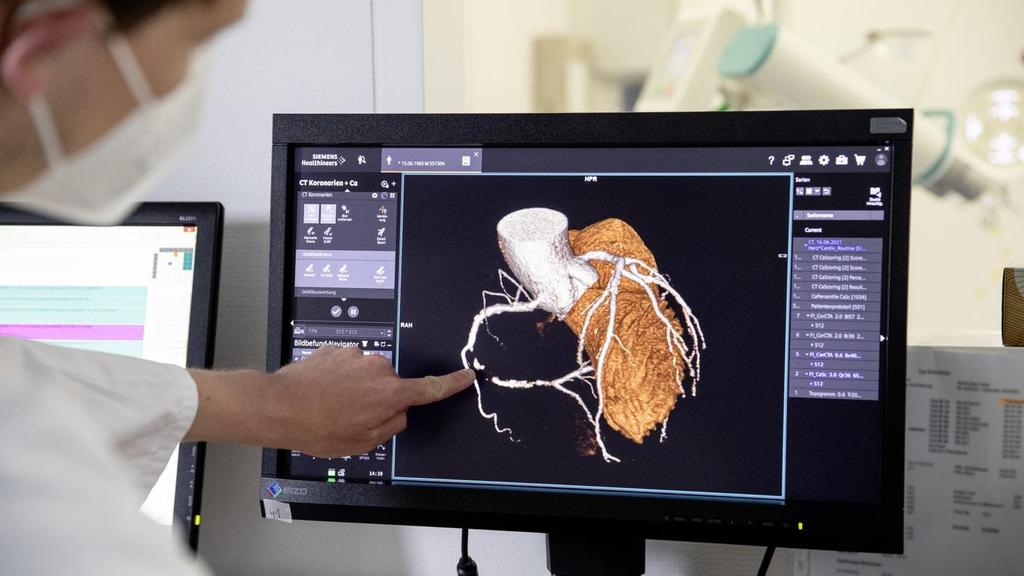Santé cardiaque : être en forme ne signifie pas être hors de danger ...