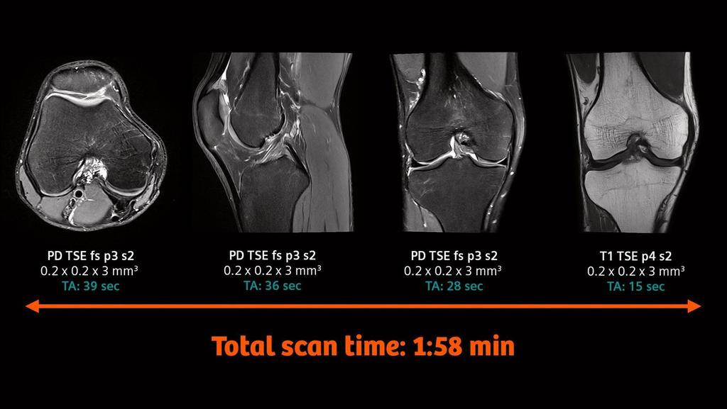 Deep Resolve - Siemens Healthineers USA