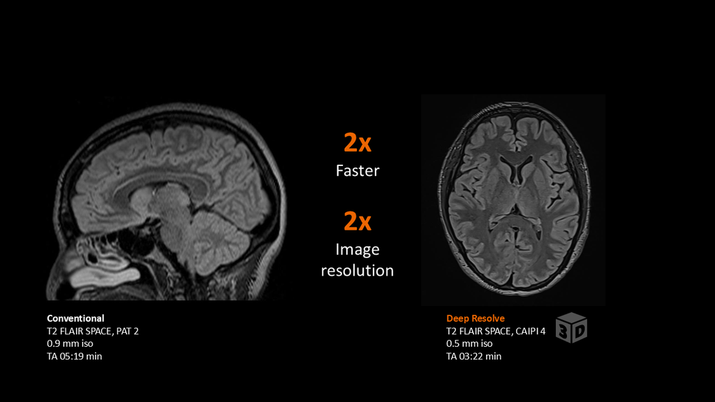 MAGNETOM Altea 新時代に求められる生産性と再現性 - Siemens Healthineers Japan