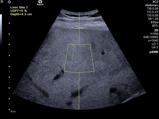 ACUSON Sequoia Ultrasound System - Siemens Healthineers USA