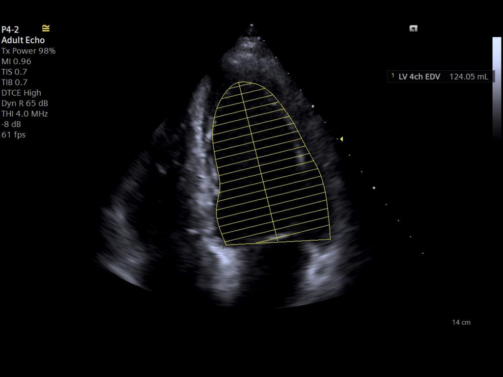 ACUSON Maple is a High-Performance Shared Service Ultrasound System ...