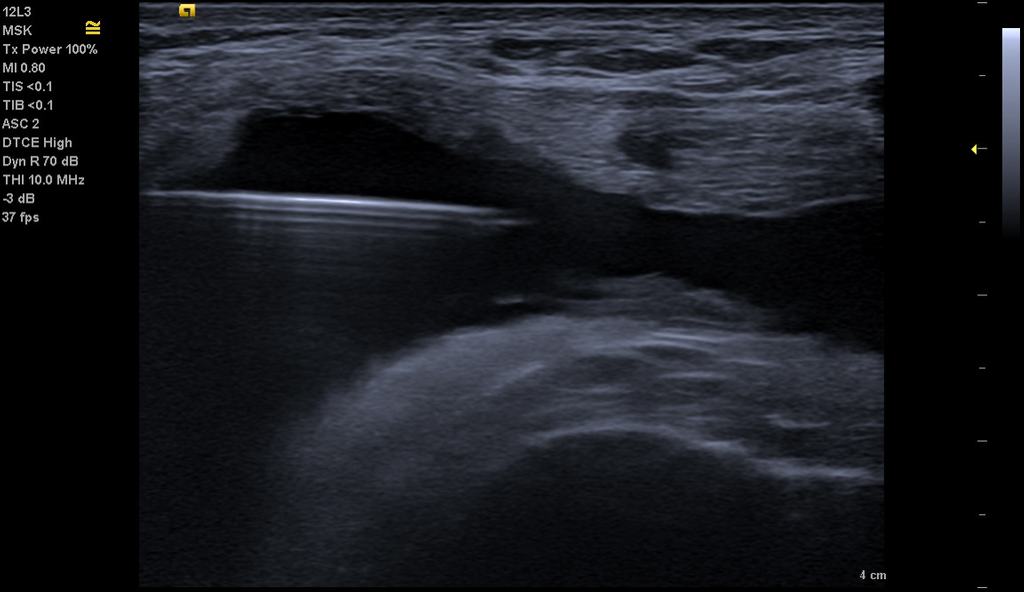MSK Ultrasound