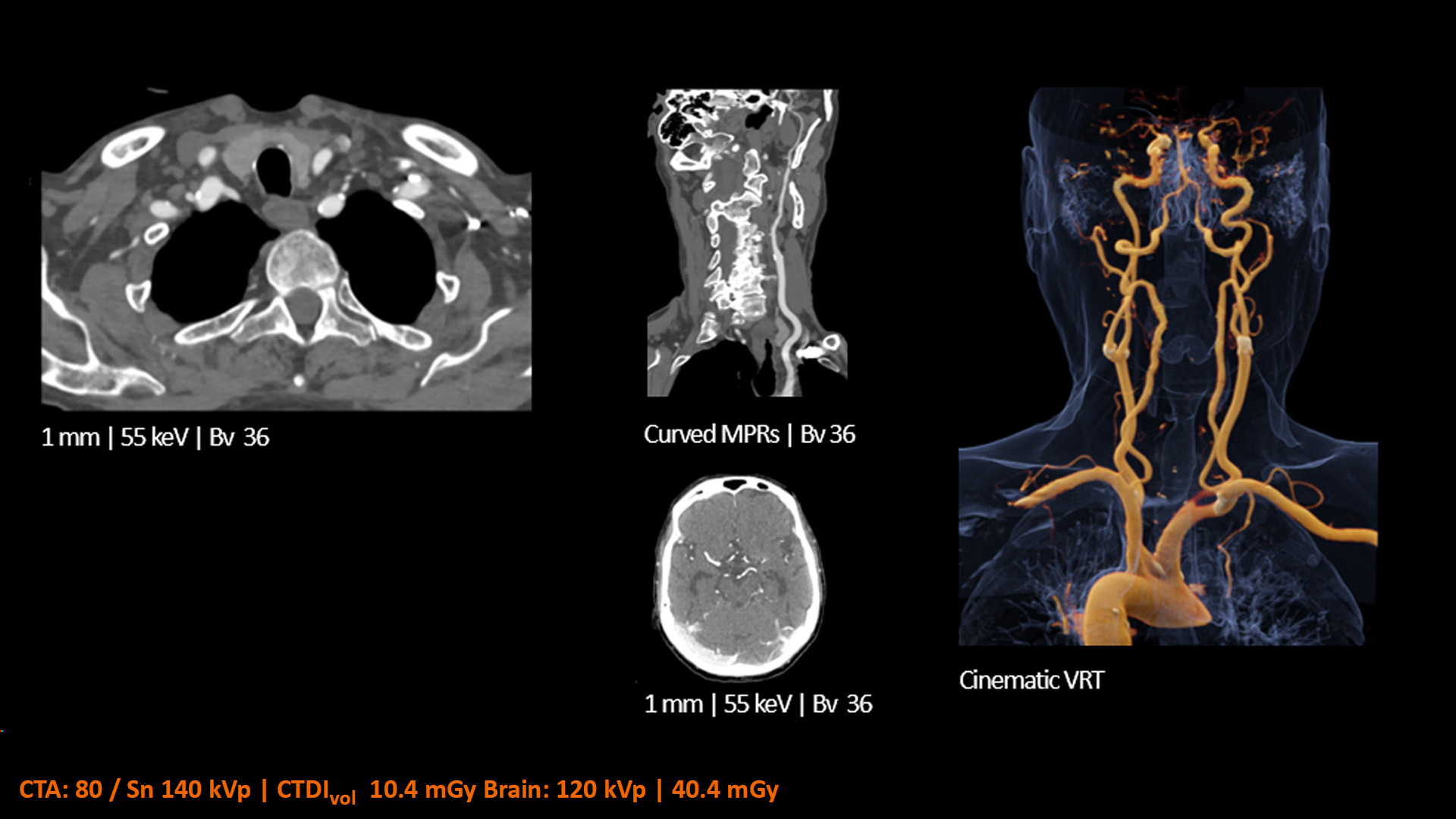 Dual Source CT - Siemens Healthineers