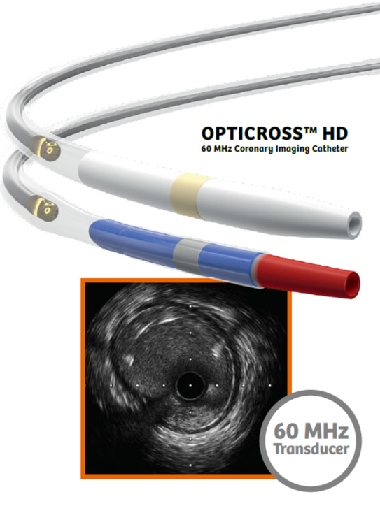 AVVIGO™+ Guidance System - Siemens Healthineers USA