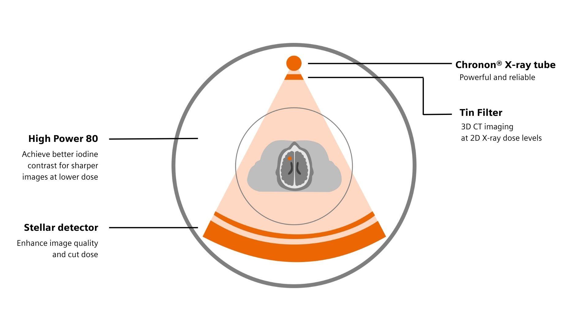 SOMATOM go.Up – Made to match - Siemens Healthineers USA