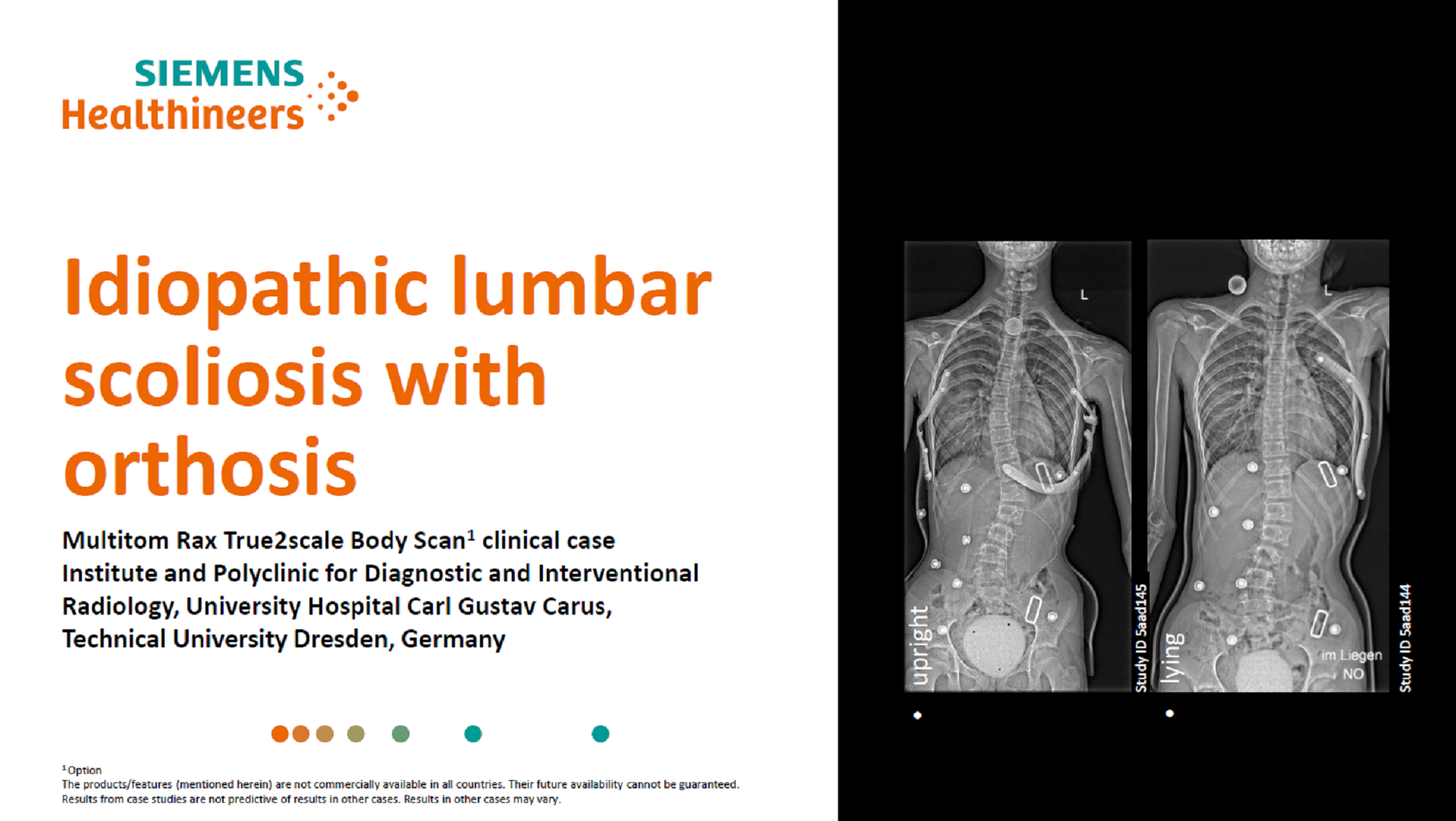 Multitom Rax With True2scale Body Scan - Siemens Healthineers