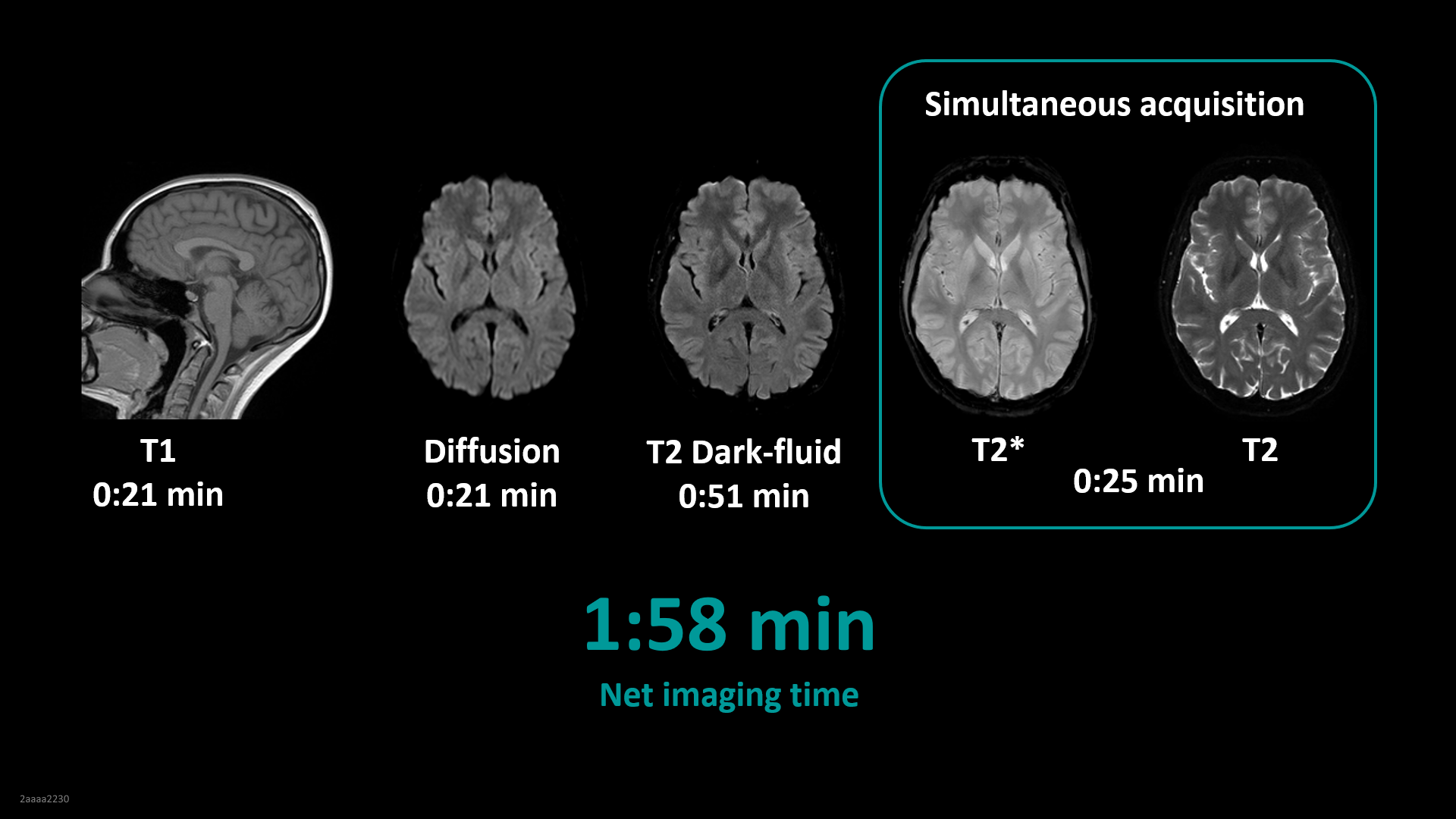 Options & Upgrades - Get the most from your investment - Siemens ...
