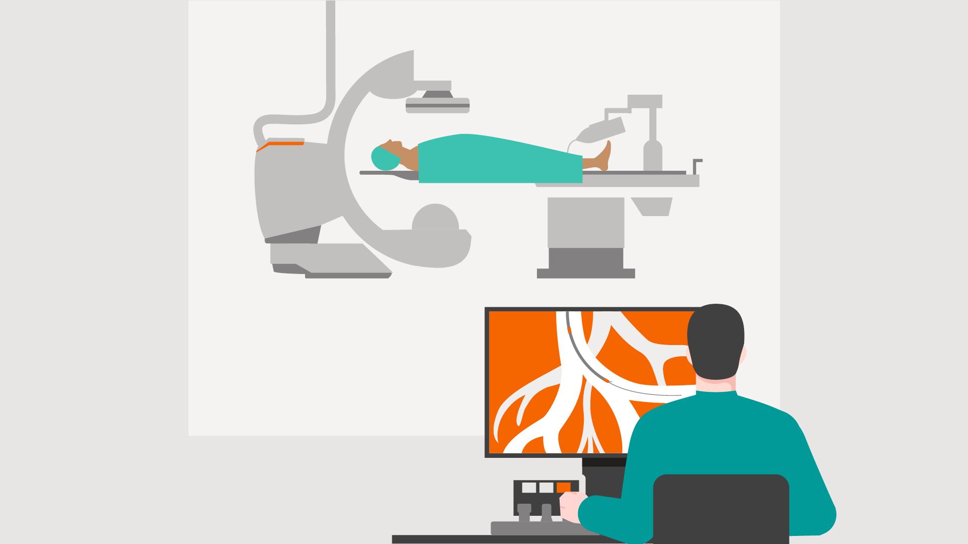 Advanced stroke management and patient care - Siemens Healthineers