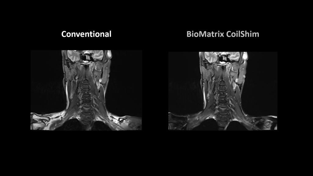 MAGNETOM Skyra Fit - Siemens Healthineers
